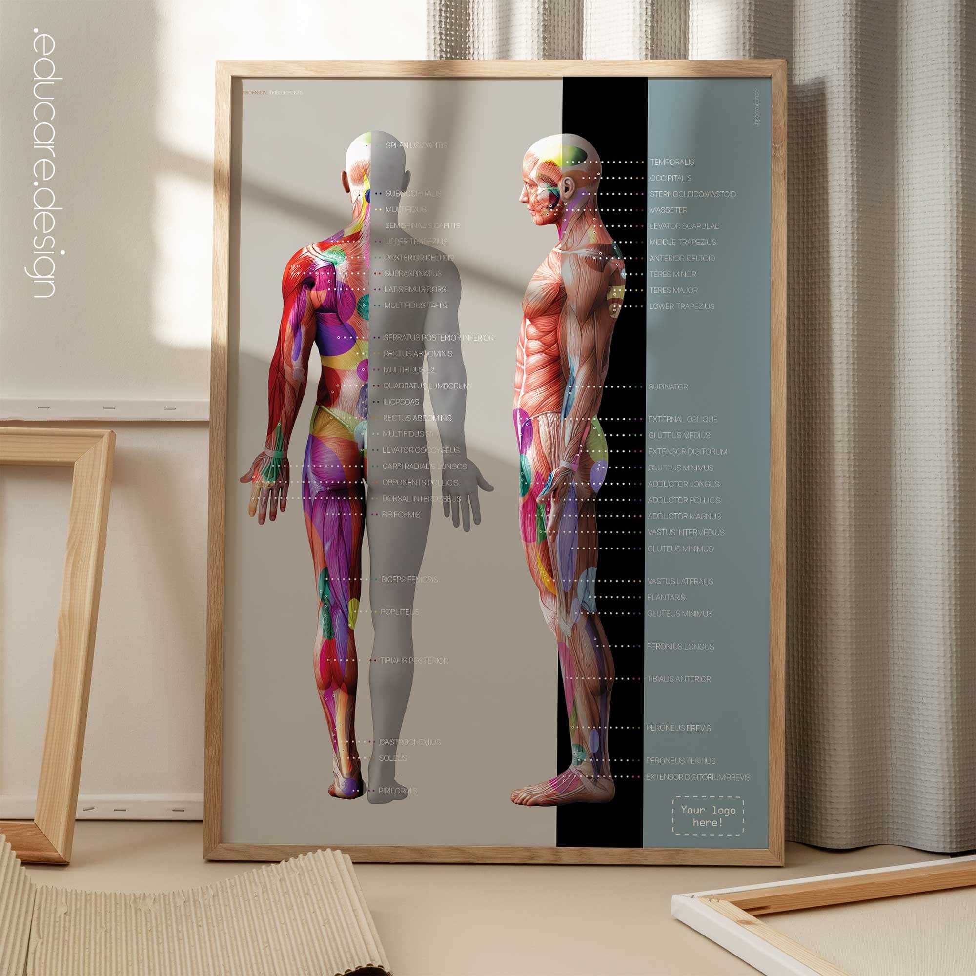 01B myofascial trigger points set