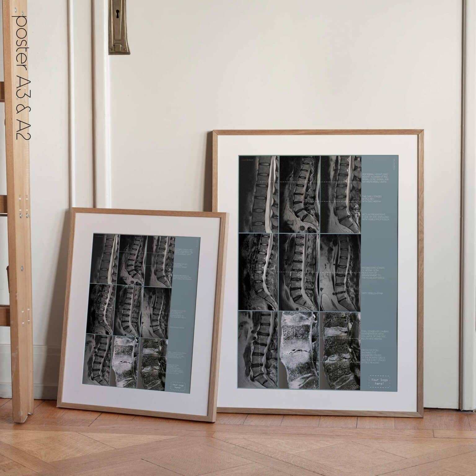 Lumbar Pathology » educare.design