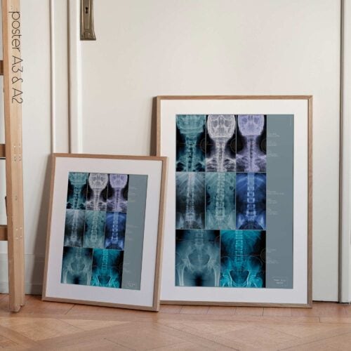 Misalignment » educare.design