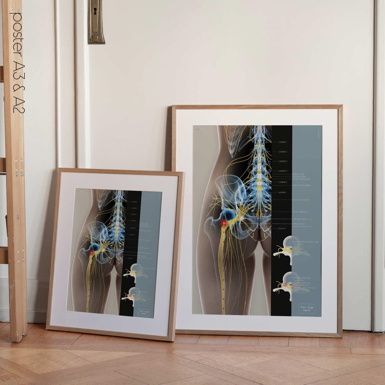 Sciatica and Stenosis » educare.design