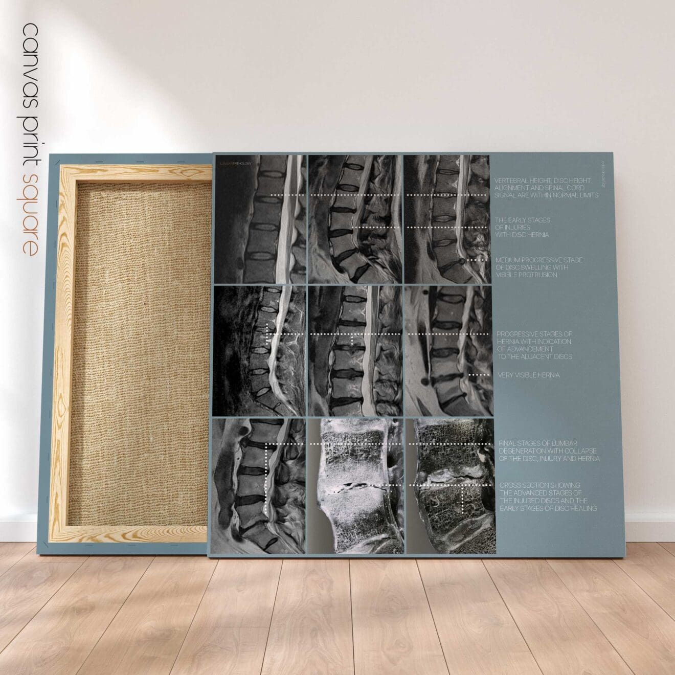 Lumbar Pathology » educare.design