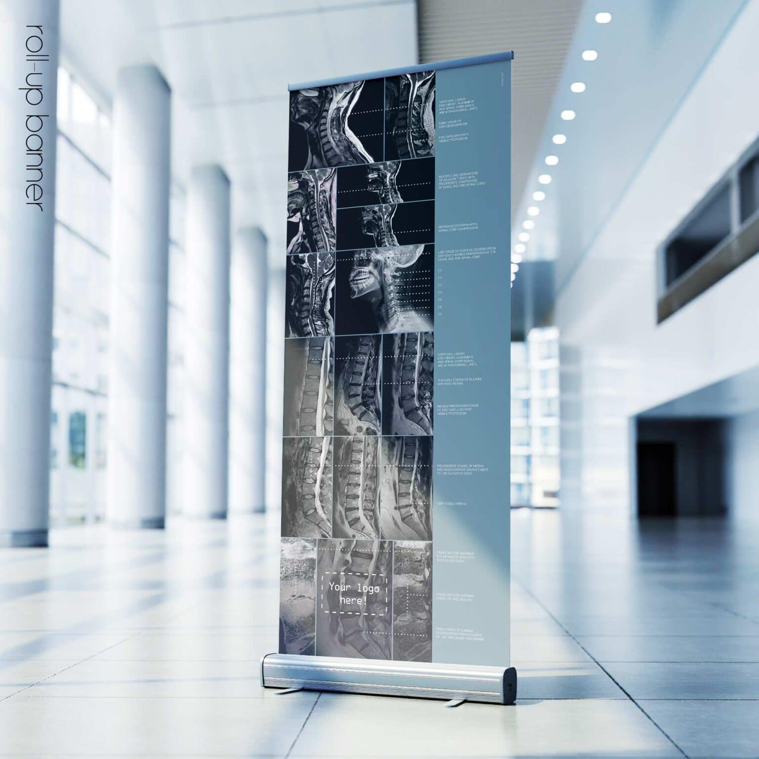 Cervical Pathology » educare.design