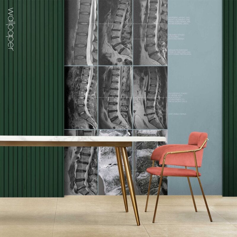 Lumbar Pathology » educare.design