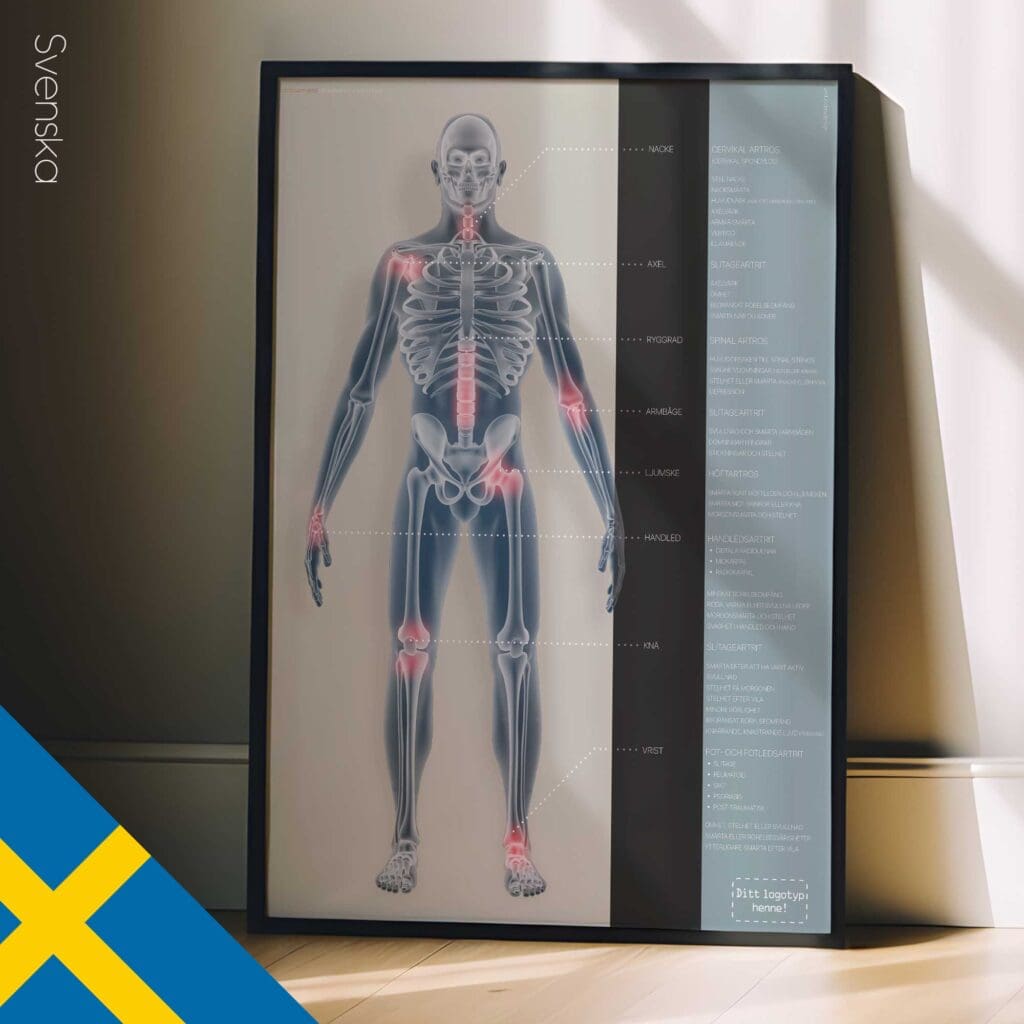 Osteoarthritis » educare.design