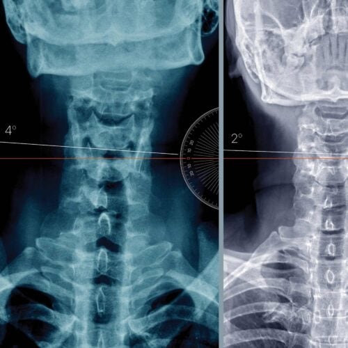 Our clinic and Spinal Misalignment