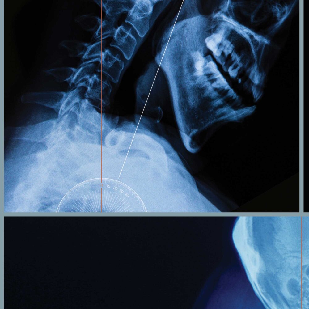 Our clinic and Forward Head Posture and Cranial Weight