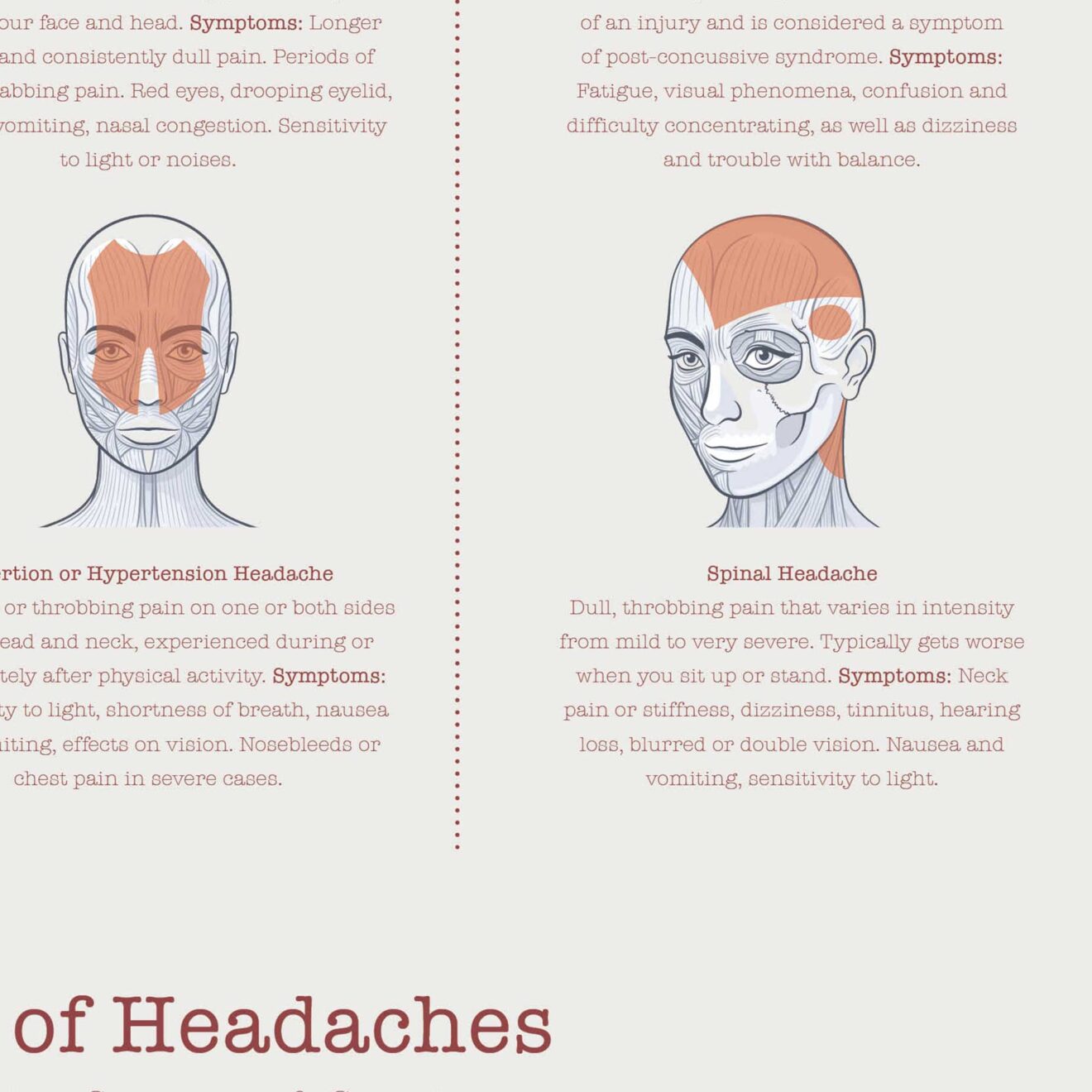 Types of Headaches » educare.design